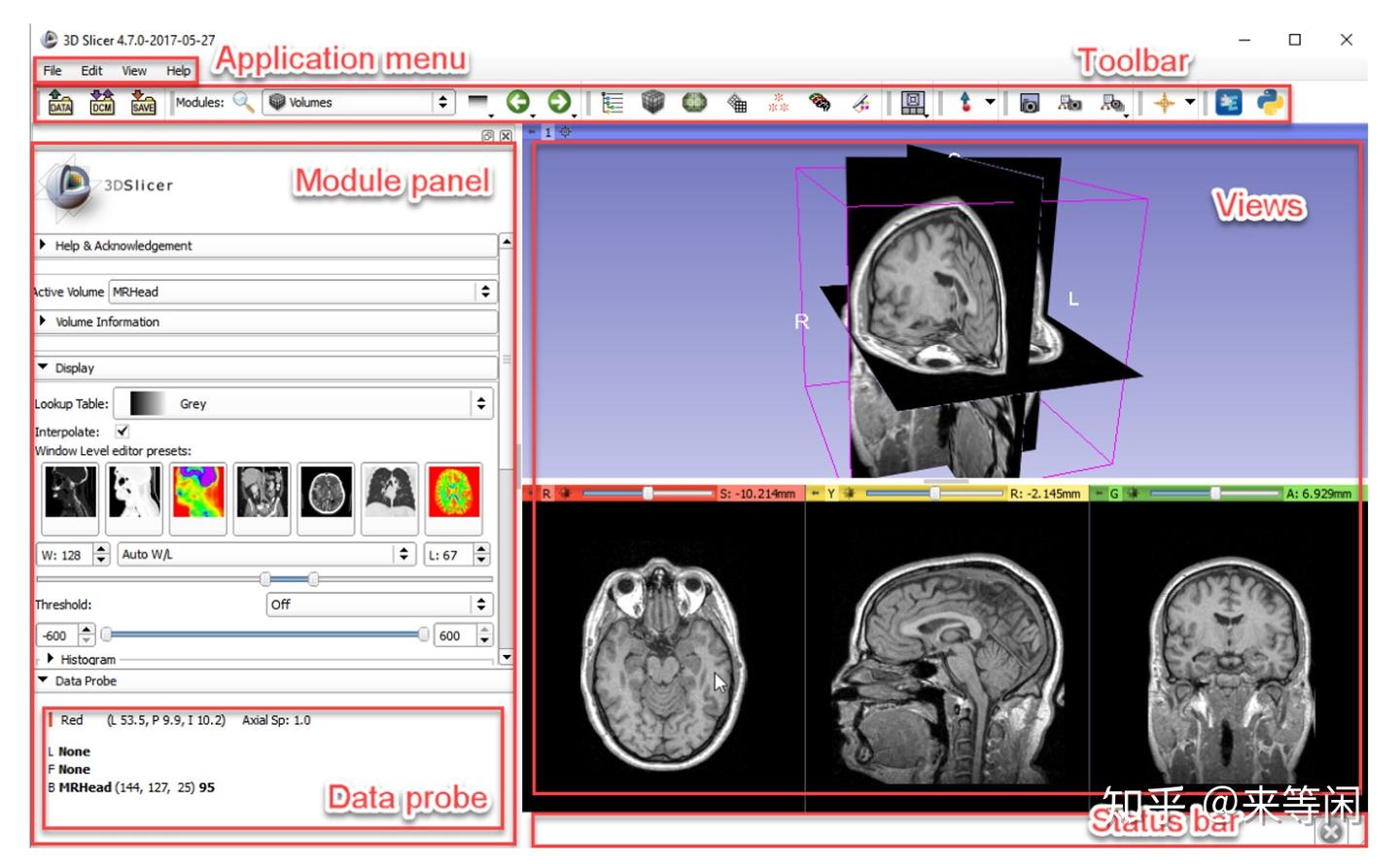 CT扫描图的三维重建 - 知乎