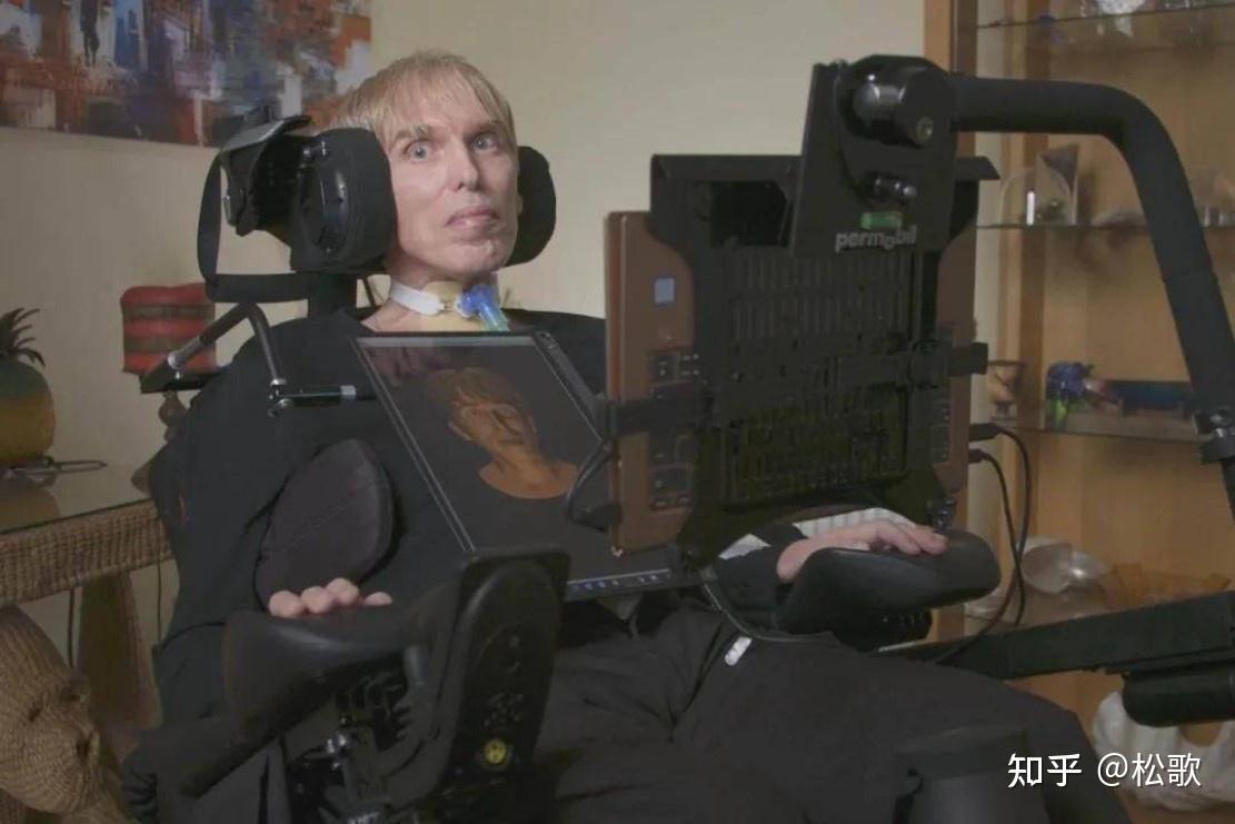 从全球首位生化电子人展望人类主动进化新征程 - 知乎