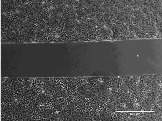 ibidi Culture-Insert划痕实验——细胞迁移 - 知乎