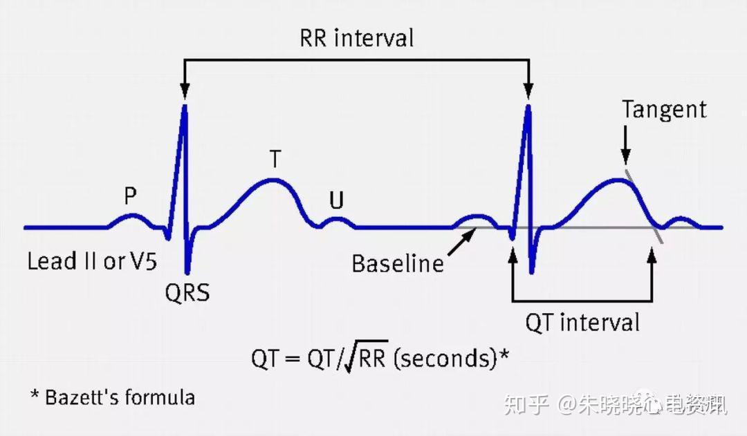 『正确』测量QT/QTc间期 - 知乎
