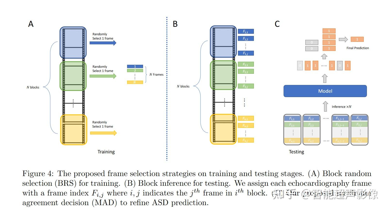 深度学习与超声心动图学术速递【2023.06.01-06.10】 - 知乎