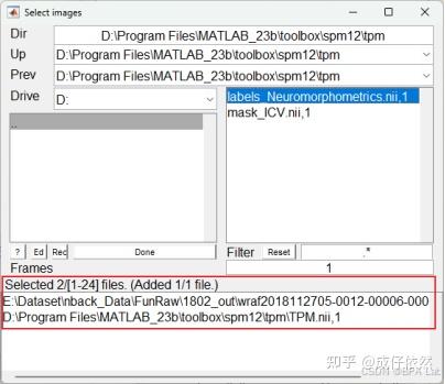 【入门且详细！fMRI信号预处理操作流程笔记】SPM12版 - 知乎