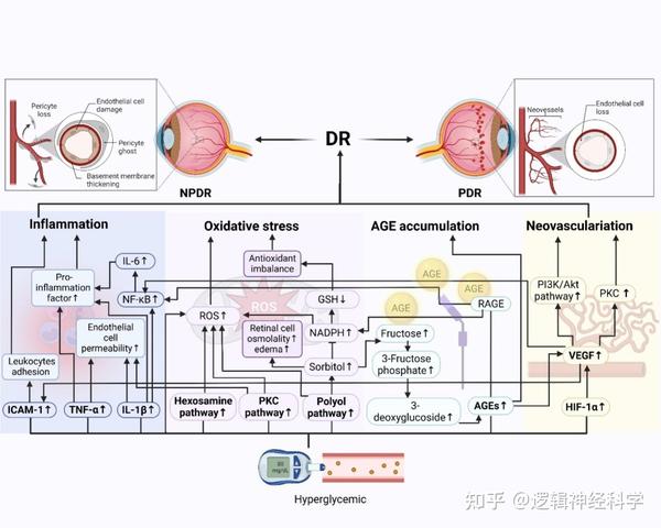 STTT 综述︱中国中医科学院刘玥团队：糖尿病泛血管病变的分子机制与治疗策略 - 知乎