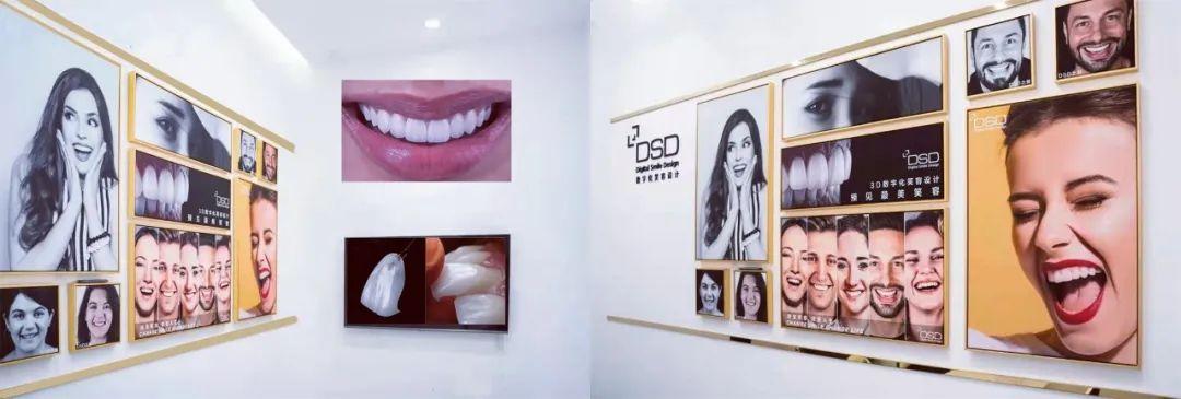 什么是口腔美学-DSD（Digital Smile Design）数字笑容？ - 知乎