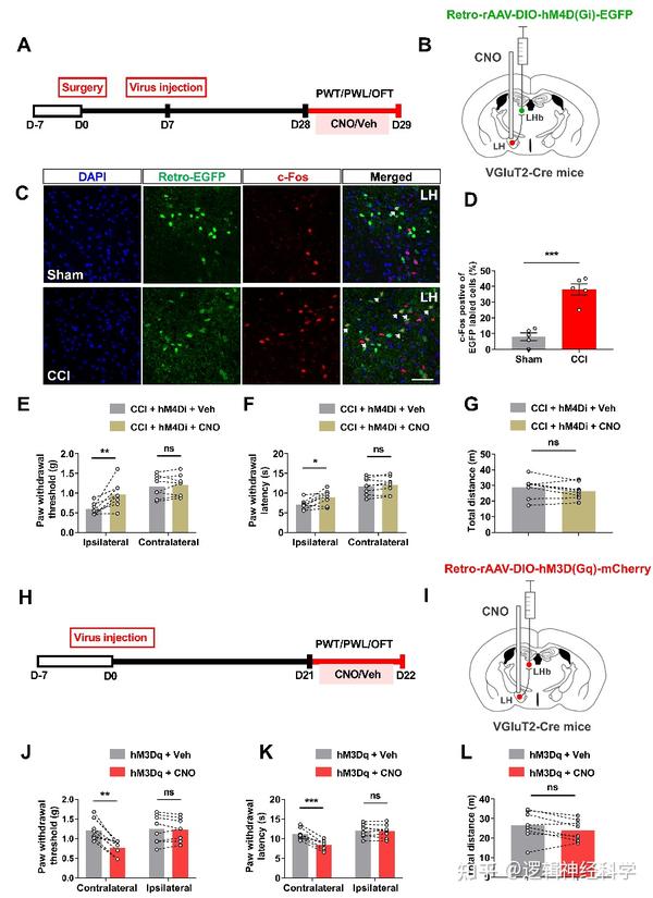 Neurobiol Dis︱郑州大学杨建军课题组揭示外侧下丘脑-外侧缰核神经环路在神经病理性疼痛中的重要作用 - 知乎