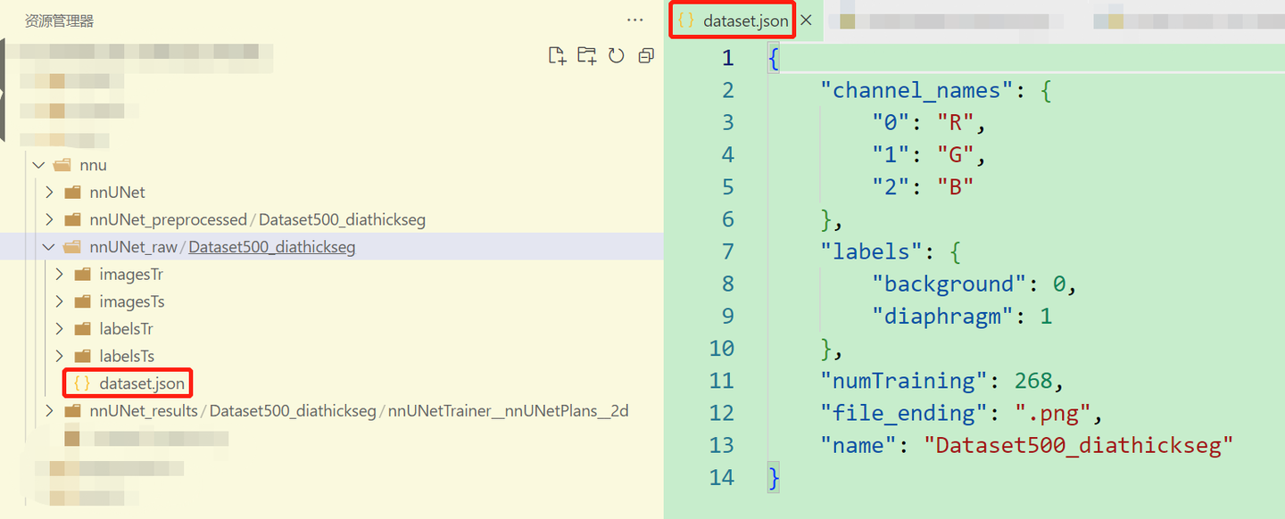 nnUnet v2项目学习记录，训练自定义模型（不是Unet） - 知乎
