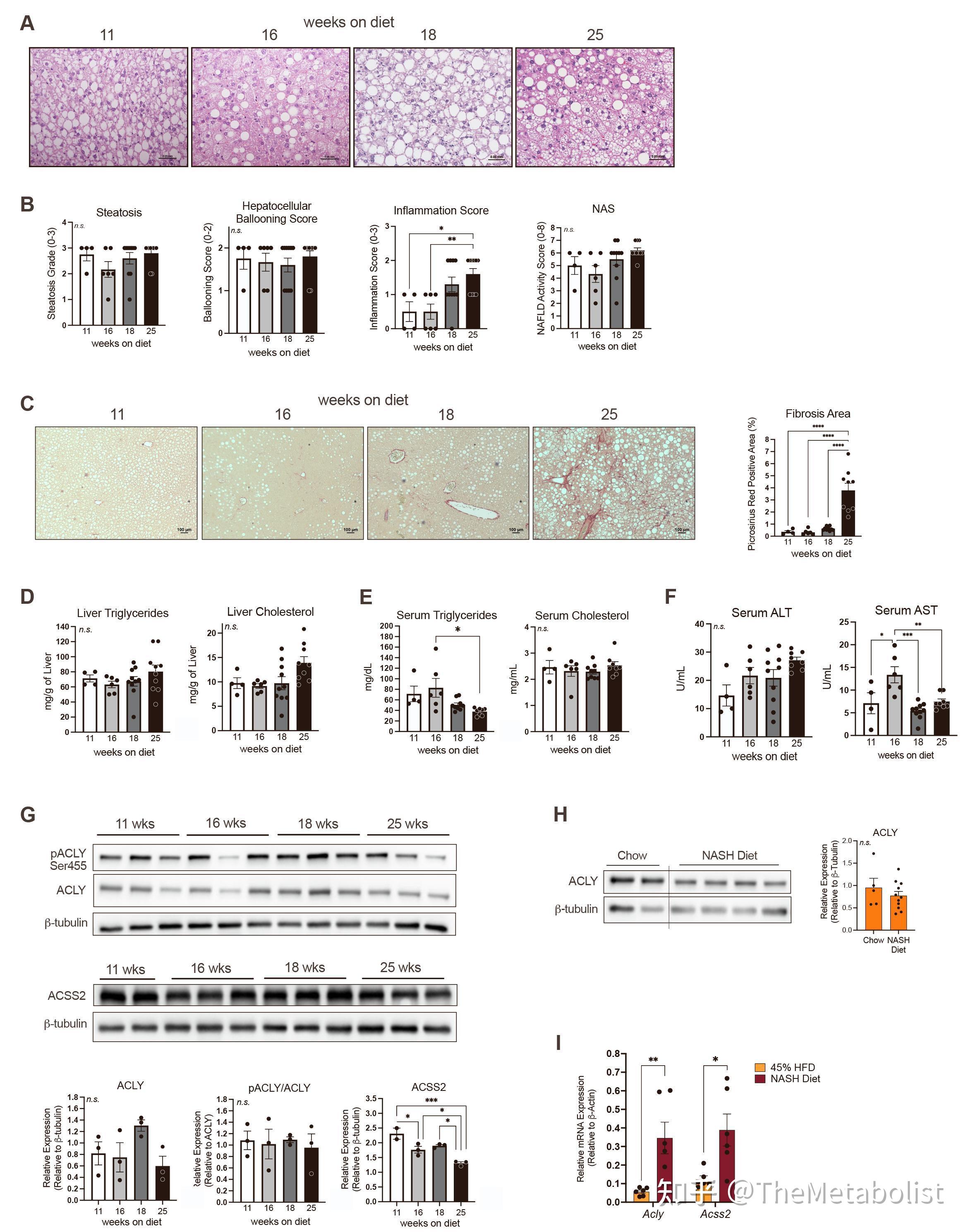 代谢学人--Cell Metabolism：NASH刺客 -- ATP柠檬酸裂解酶 - 知乎