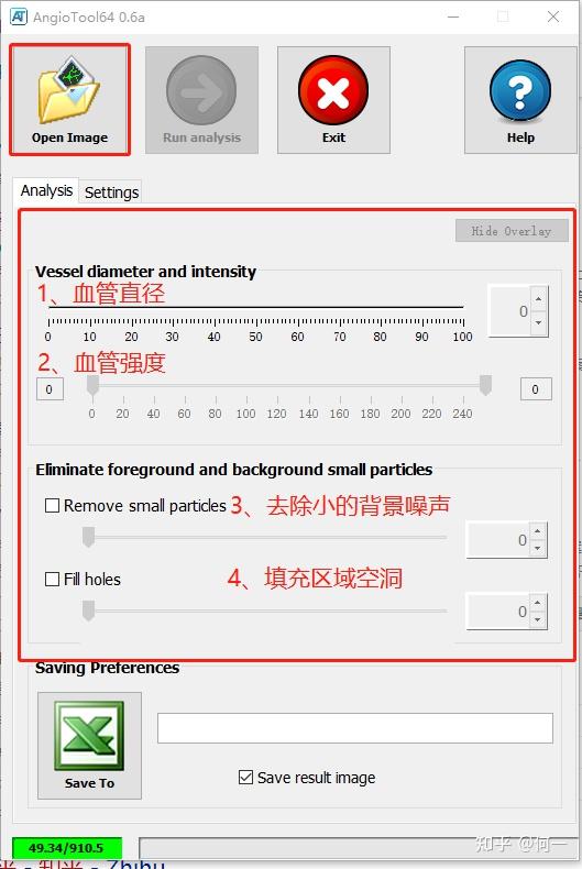 Angiotool 血管参数分析软件 - 知乎
