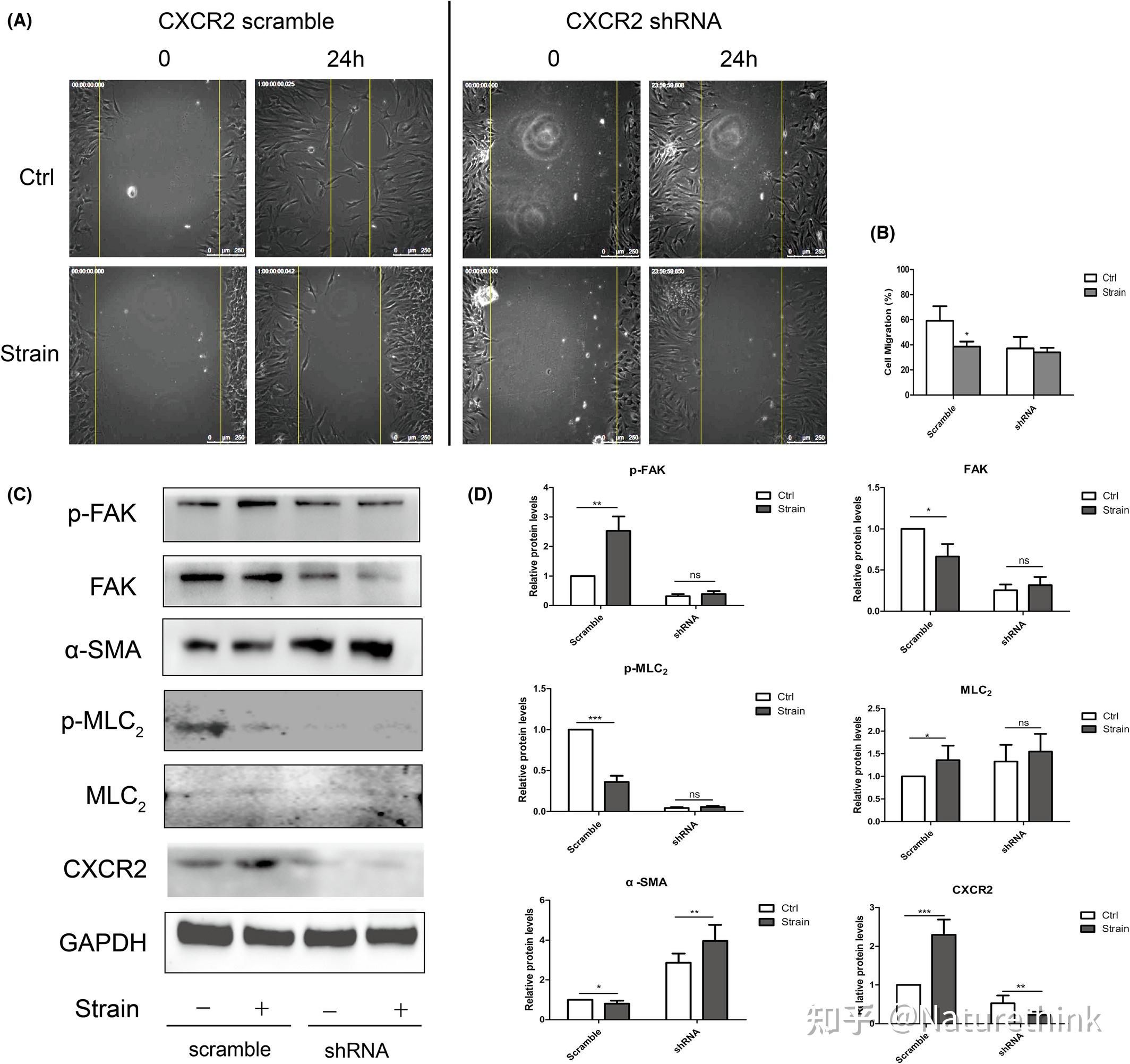 CXC-受体2在机械应变下促进细胞外基质的产生并减弱视盘周围人巩膜成纤维细胞的迁移 - 知乎