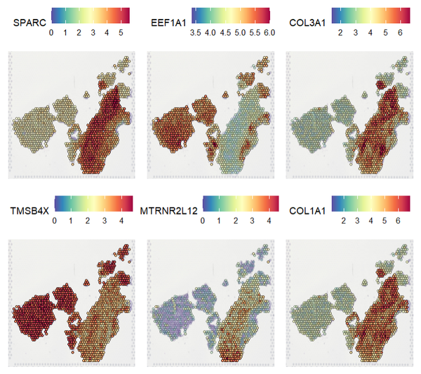 空间转录组|Load10X_Spatial函数修改适配多形式数据 + 空转标准流程 - 知乎