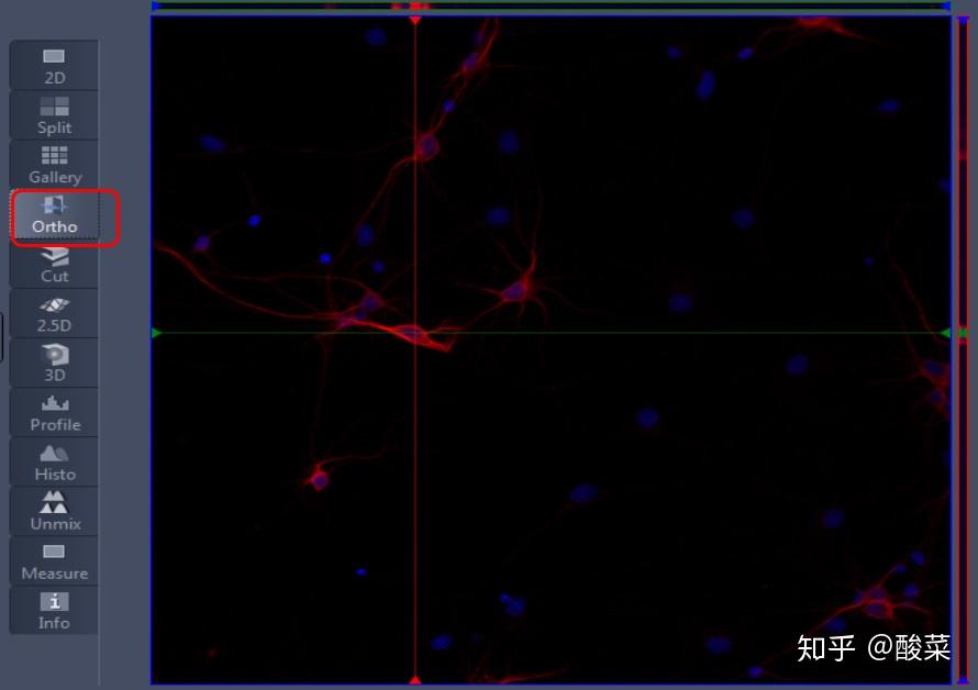 手把手教会荧光共定位分析 - 知乎