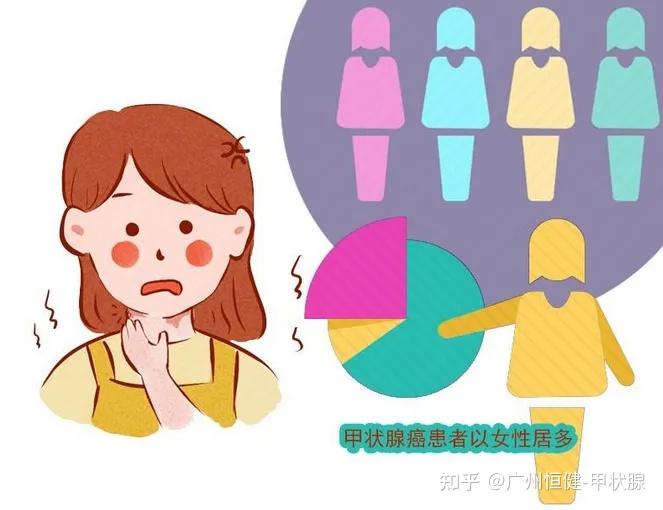 为什么女性更容易患甲状腺癌? 知乎