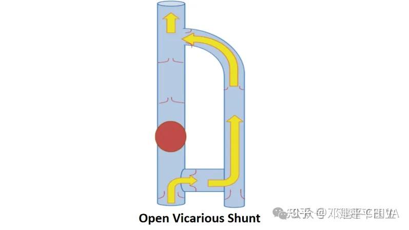 CHIVA语言中的Shunt概念与分类 - 知乎