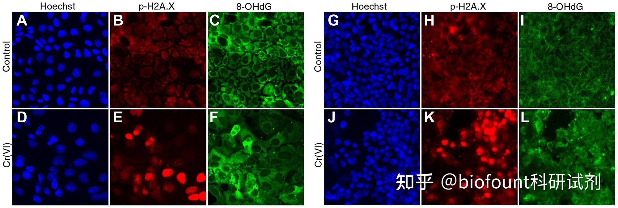 8-OHDG；DNA损伤检测试剂 - 知乎