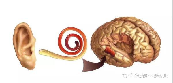 客观的“言语测听”丨皮层诱发电位（CAEP）（一） - 知乎