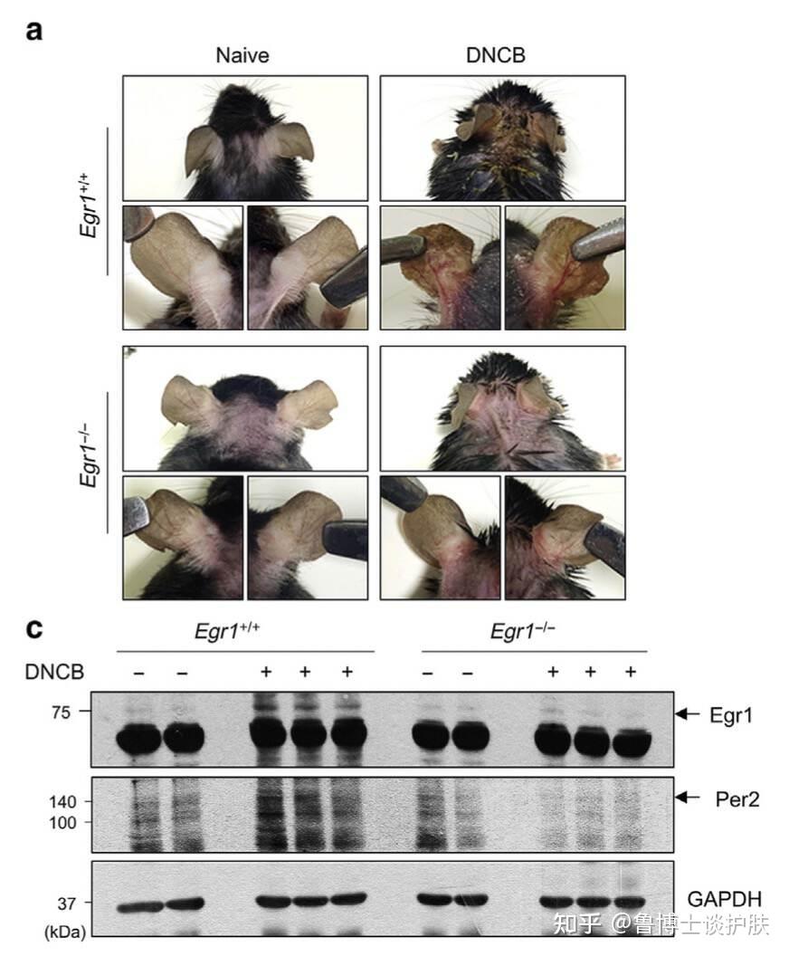 炎症因子IL-4通过EGR1调控节律系统中枢基因PER2 - 知乎