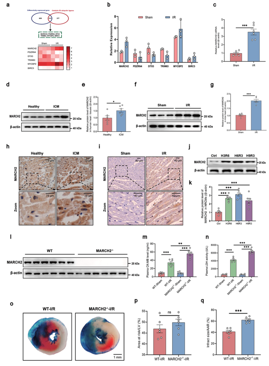 Cell Discovery丨IF：33.5丨MARCH2通过抑制焦亡从而保护心肌缺血再灌注损伤 - 知乎