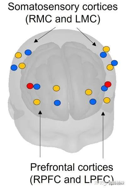 老年人Stroop任务期间颈动脉粥样硬化与脑激活模式的联系：fNIRS研究 - 知乎