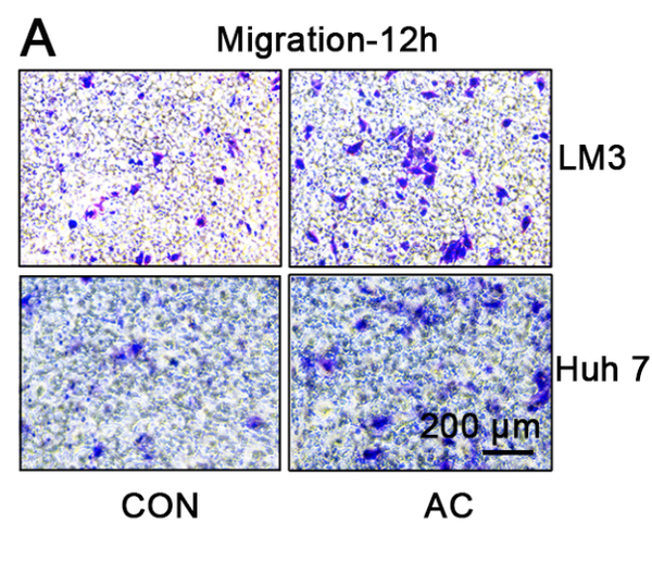 文献精读{酸+转移}：Two-way Column统计与作图 - 知乎