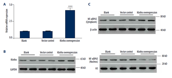 Klotho蛋白在皮肤光防护中的作用 - 知乎