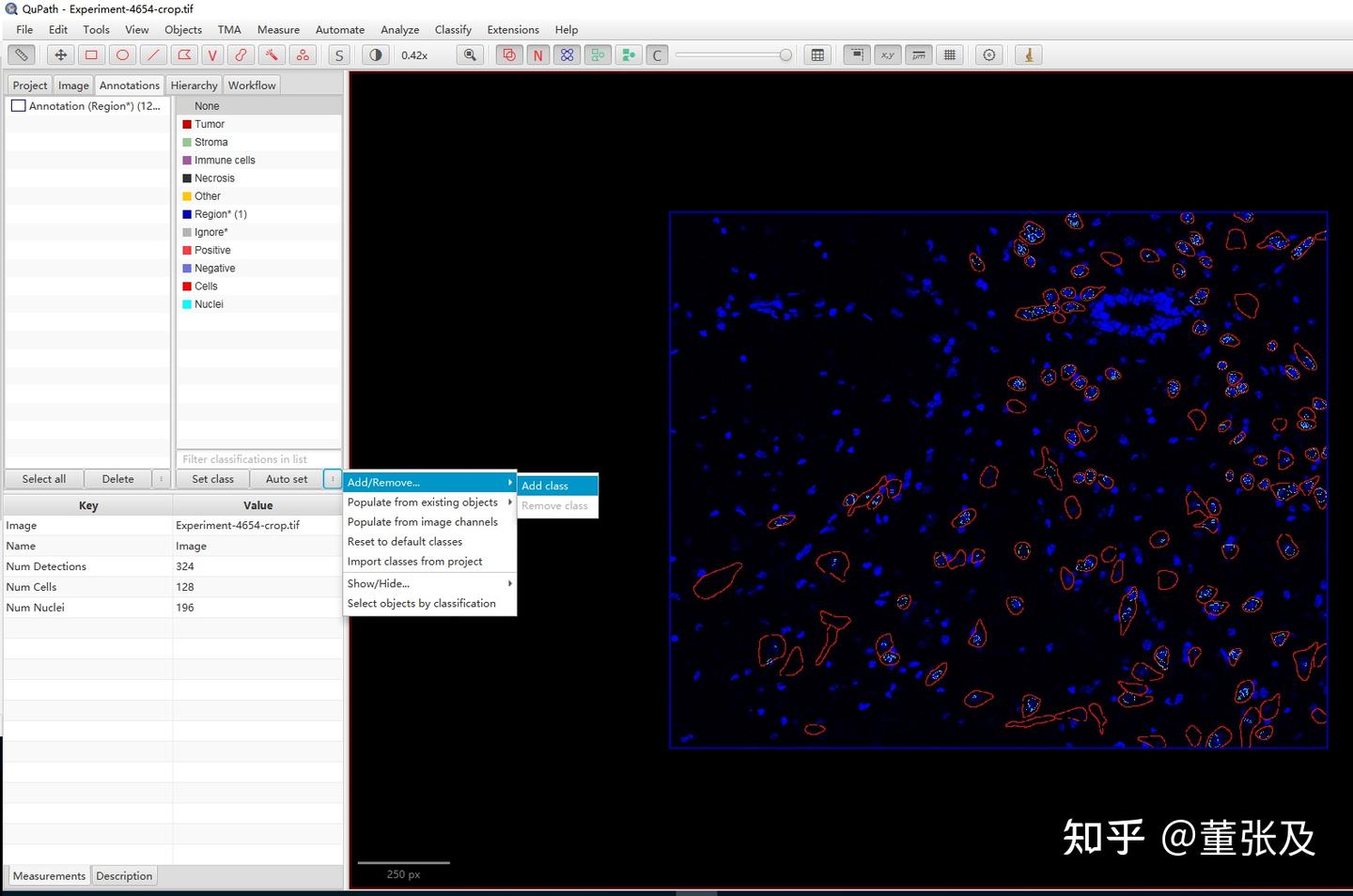 使用QuPath+Cellpose+StarDist分析蛋白入核比率 - 知乎