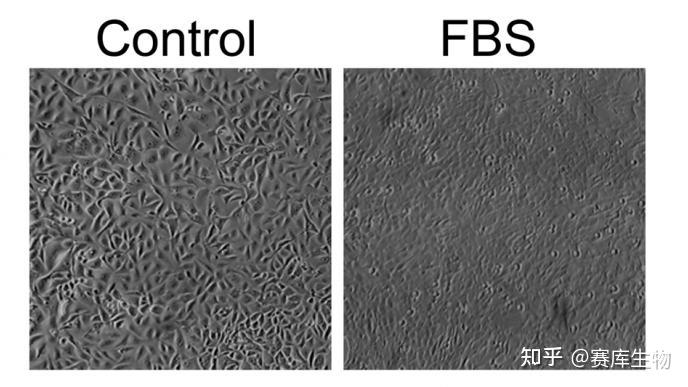 细胞学堂 |如何培养人正常支气管上皮细胞BEAS-2B - 知乎