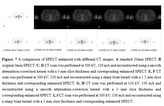 前沿学术｜SPECT/CT骨扫描7倍超快速成像进入临床应用 - 知乎