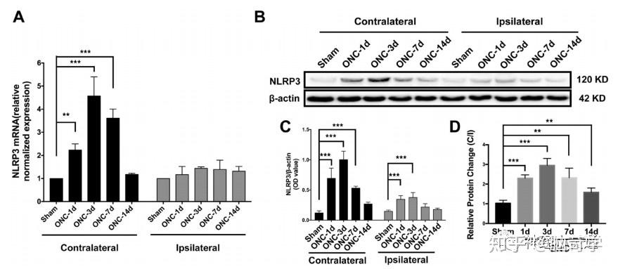 Neurosci Bull (IF 4.246) | NLRP3基因缺失可减轻视神经损伤后视觉皮质神经元的继发性退化 - 知乎
