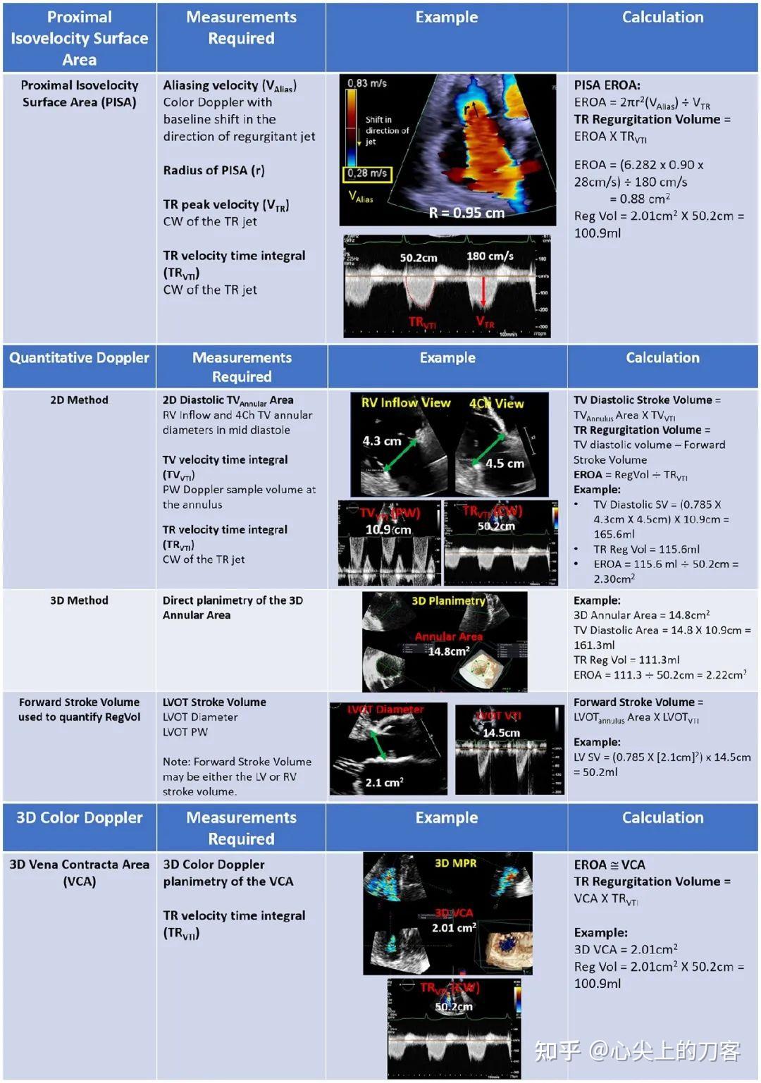 三尖瓣关闭不全之病理生理、分级和预后认识的最新进展 - 知乎