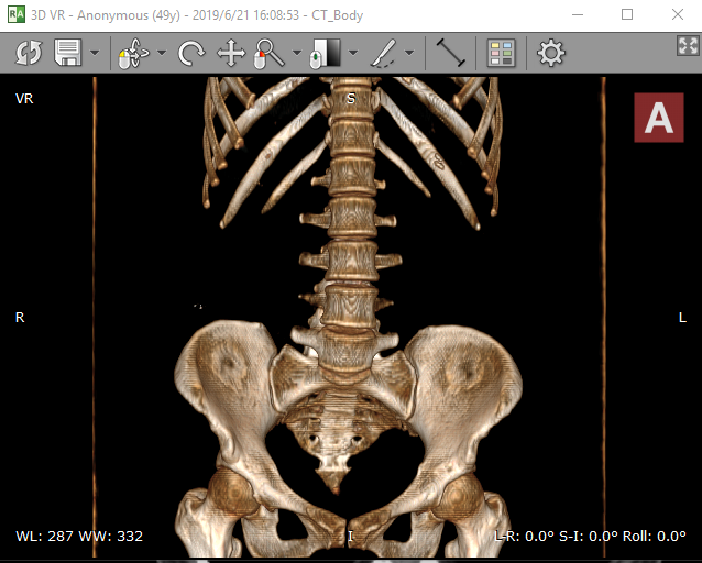 医学影像专业必备的DICOM Viewer软件 - 知乎