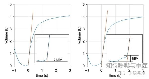 第169期 肺通气功能检查及结果分析 - 知乎