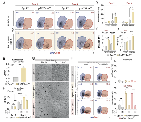 免疫学顶刊JEM丨GPX4-结核病-细胞死亡丨从临床到基础 - 知乎