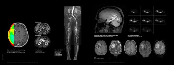 最新！飞利浦磁共振成像系统MR 7700获FDA批准 - 知乎