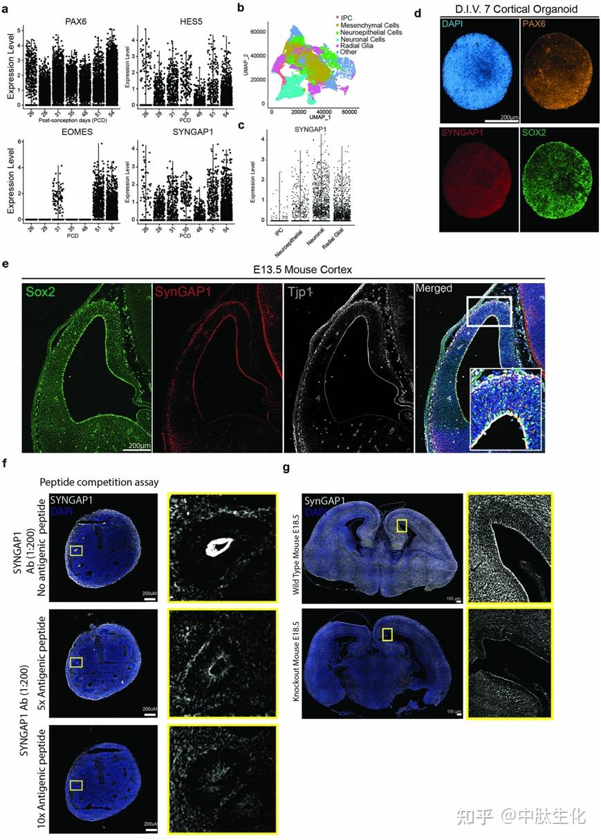 Nat Neurosci：揭示SYNGAP1基因在早期的大脑发育中起着重要作用 - 知乎