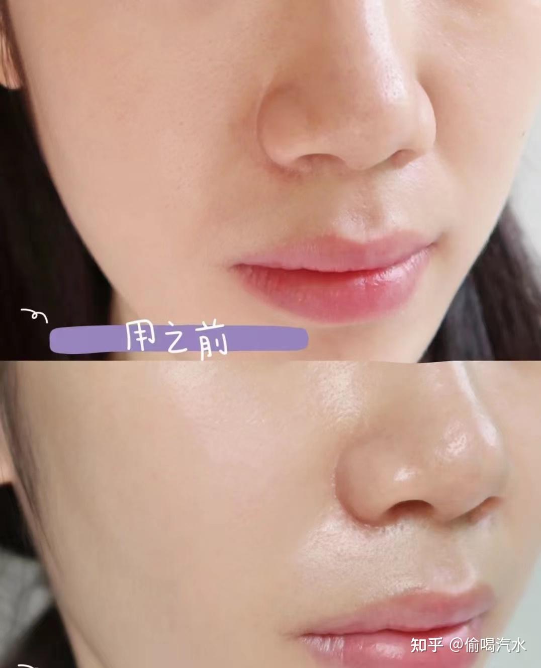 怎么能让皮肤变白？学会党怎么便宜的美白？ 知乎