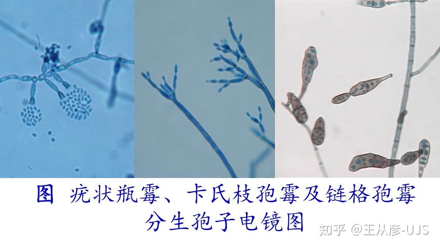 环境微生物之真菌 - 知乎