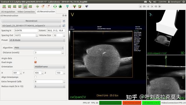 开源科学工程技术软件介绍65 – 用于图像引导治疗的研究平台CustusX - 知乎