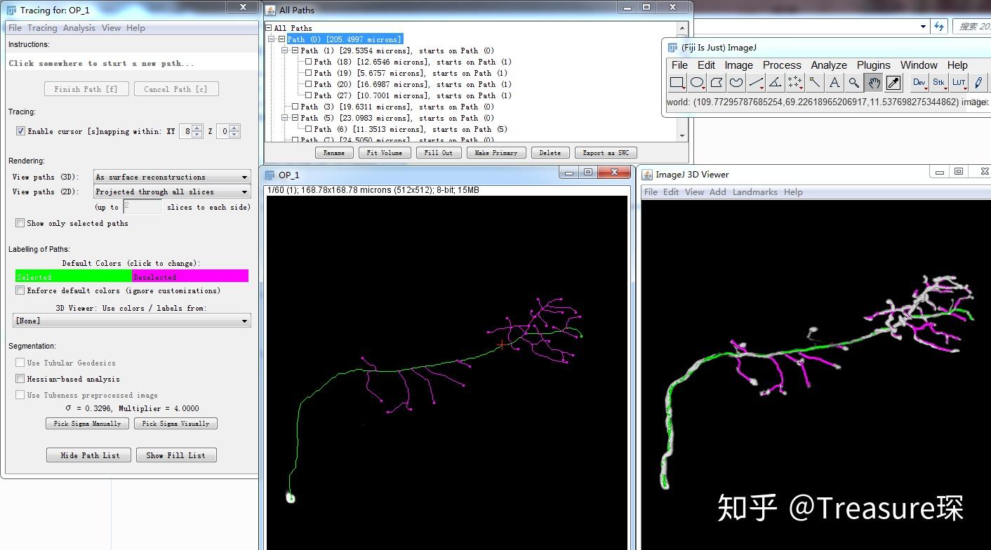 ImageJ实用技巧——Sholl Analysis（一）(插件篇) - 知乎