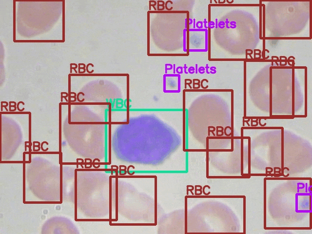 在自定义数据集上训练RetinaNet（ 基于PyTorch ） - 知乎