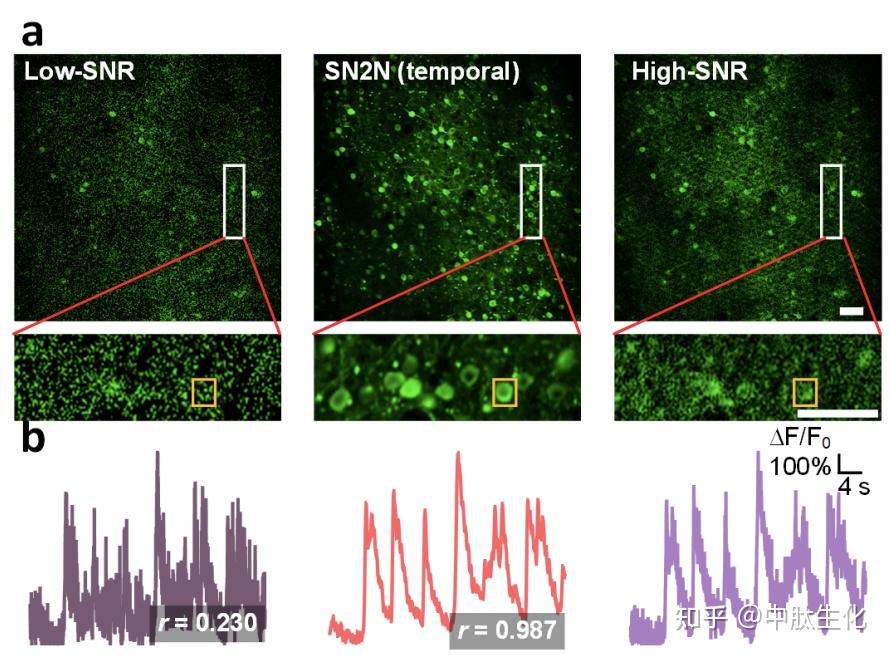 Nat Methods：赵唯淞/李浩宇/陈良怡合作发明SN2N自启发去噪方法，实现快速、温和的长时程超分辨成像 四色活细胞超分辨成像 - 知乎