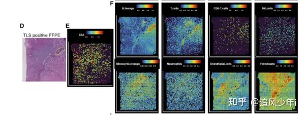 10X空间转录组重点分析合集 - 知乎