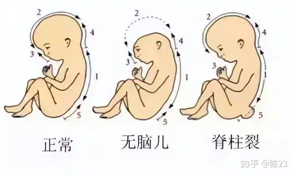 CC型、CT型、TT型啥意思？ - 知乎