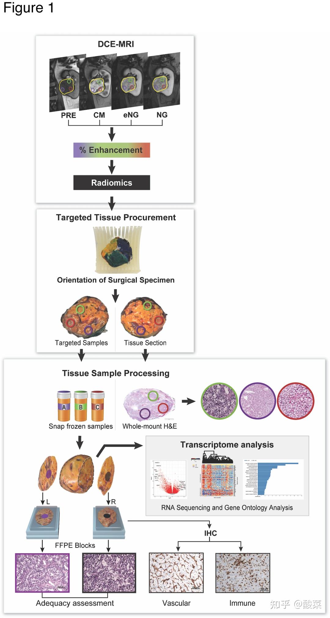 最热影像组学+单细胞多组学套路模板，教你轻松上10分！ - 知乎