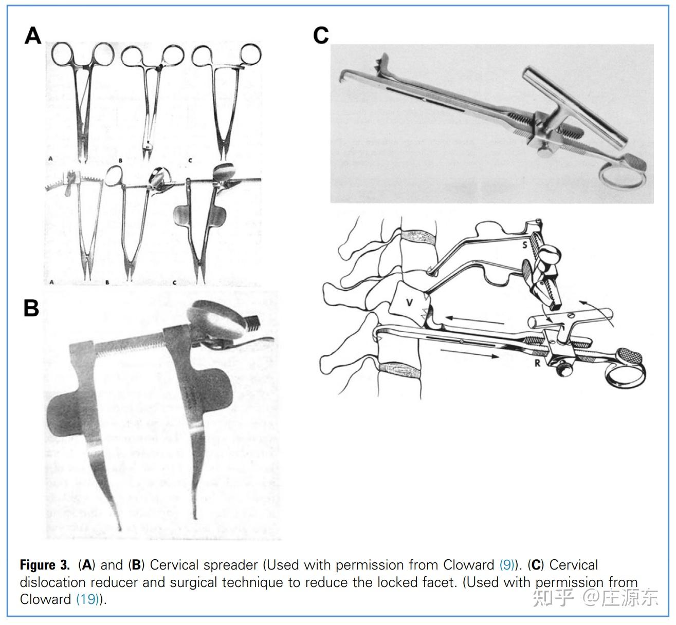 Ralph Bingham Cloward-颈椎前路椎间盘切除椎间融合术的发明者 - 知乎