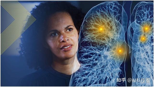 拜耳推出Calantic®数字化解决方案，影像诊断业务拓展人工智能市场 - 知乎