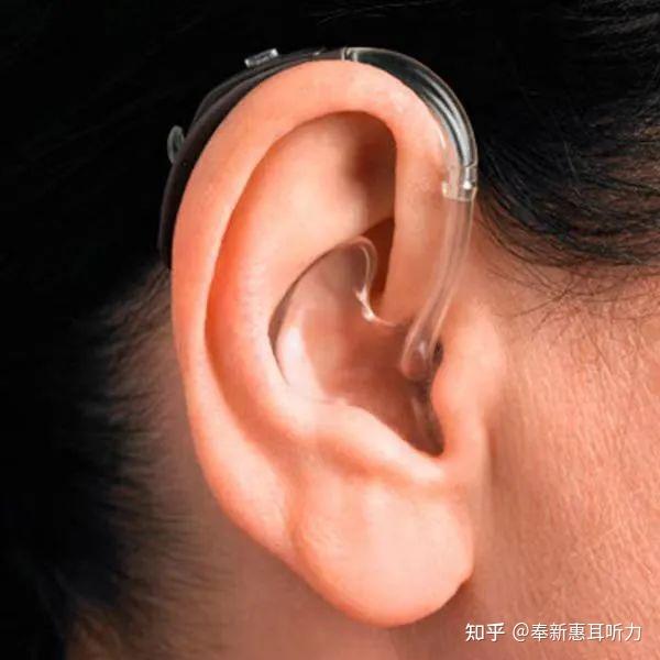 耳模的优点，你知道吗？ - 知乎
