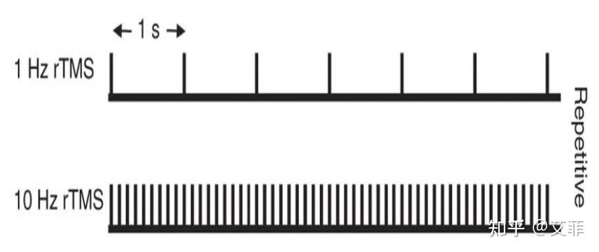 脑科学研究方法（四）经颅磁刺激（TMS） - 知乎