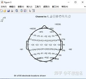 基于Matlab EEGLAB（ERPLAB）工具箱的脑电EEG分析教程 - 知乎