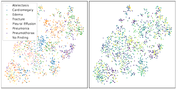 论文笔记：Multi-Granularity Cross-modal Alignment for Generalized Medical Visual Representation ...