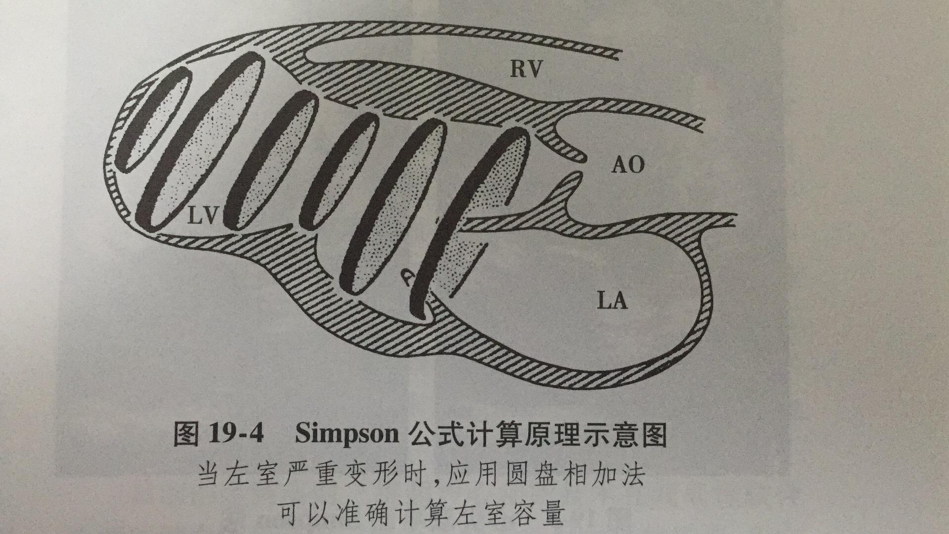 左心室收缩功能测量 - 知乎
